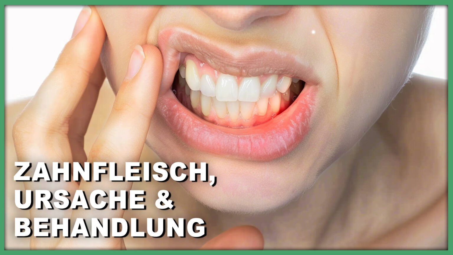 Zahnfleischprobleme, Symptome und Behandlung - Welt Der Gesundheit